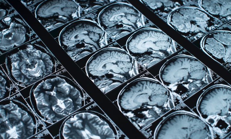 The 4 R’s of the Trauma-Informed Approach – Better & Betterer